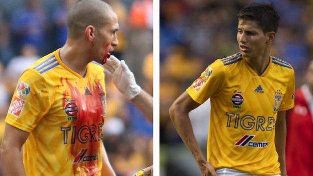 Cinco puntos de sutura para el Pechu; Damm sufrió un golpe | Telediario ...