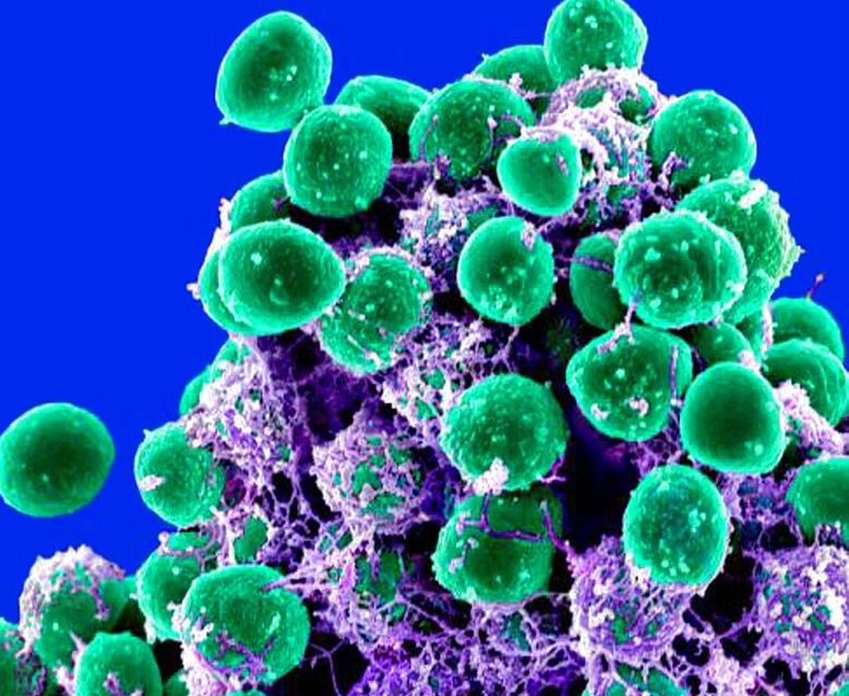 Microbios podrían ayudar a pronosticar futura salud | Telediario México