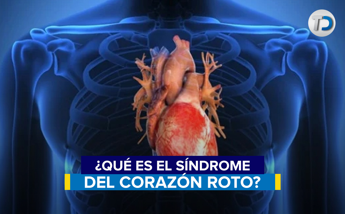 Síndrome del corazón roto: causas y síntomas de la enfermedad ...