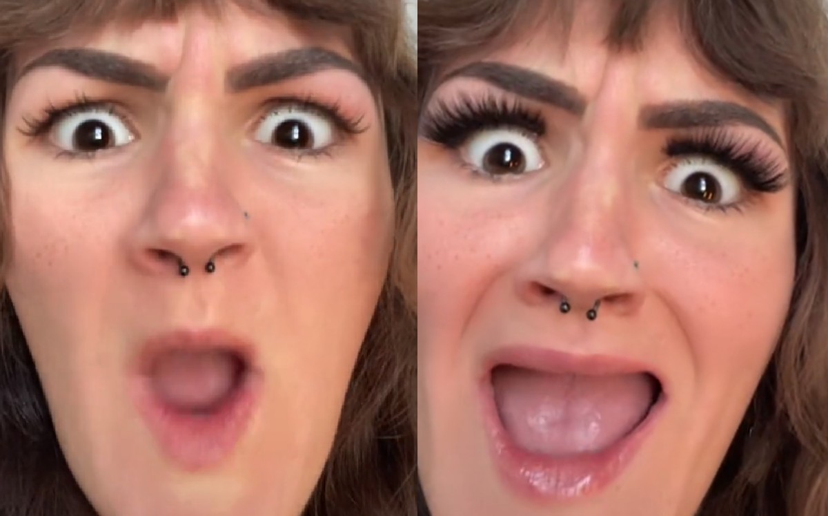 Mujer comparte en TikTok cómo es vivir sin dientes| Telediario México