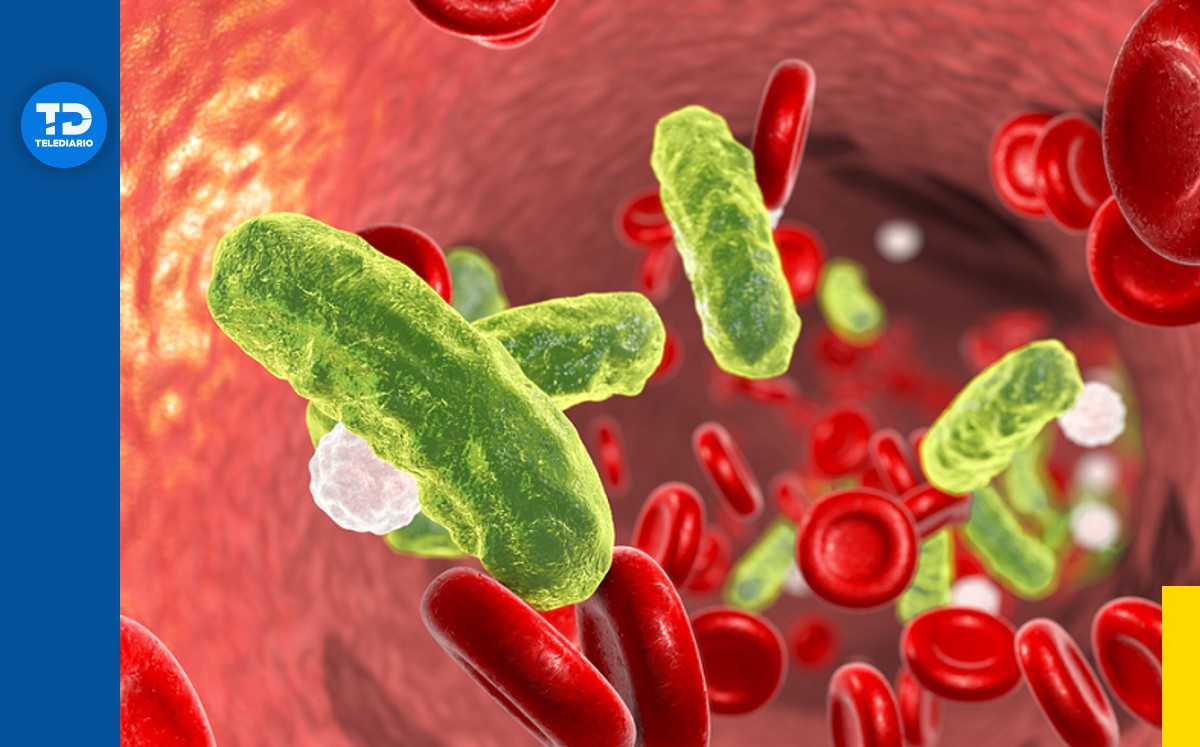 13 de septiembre | Día mundial de la sepsis: ¿Qué es y sintomas?| Telediario México